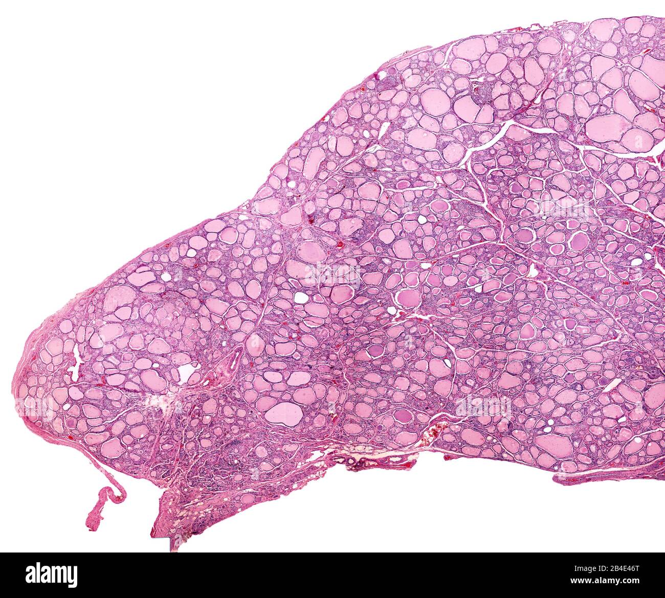 Low magnification micrograph showing a human thyroid. The thyroid ...