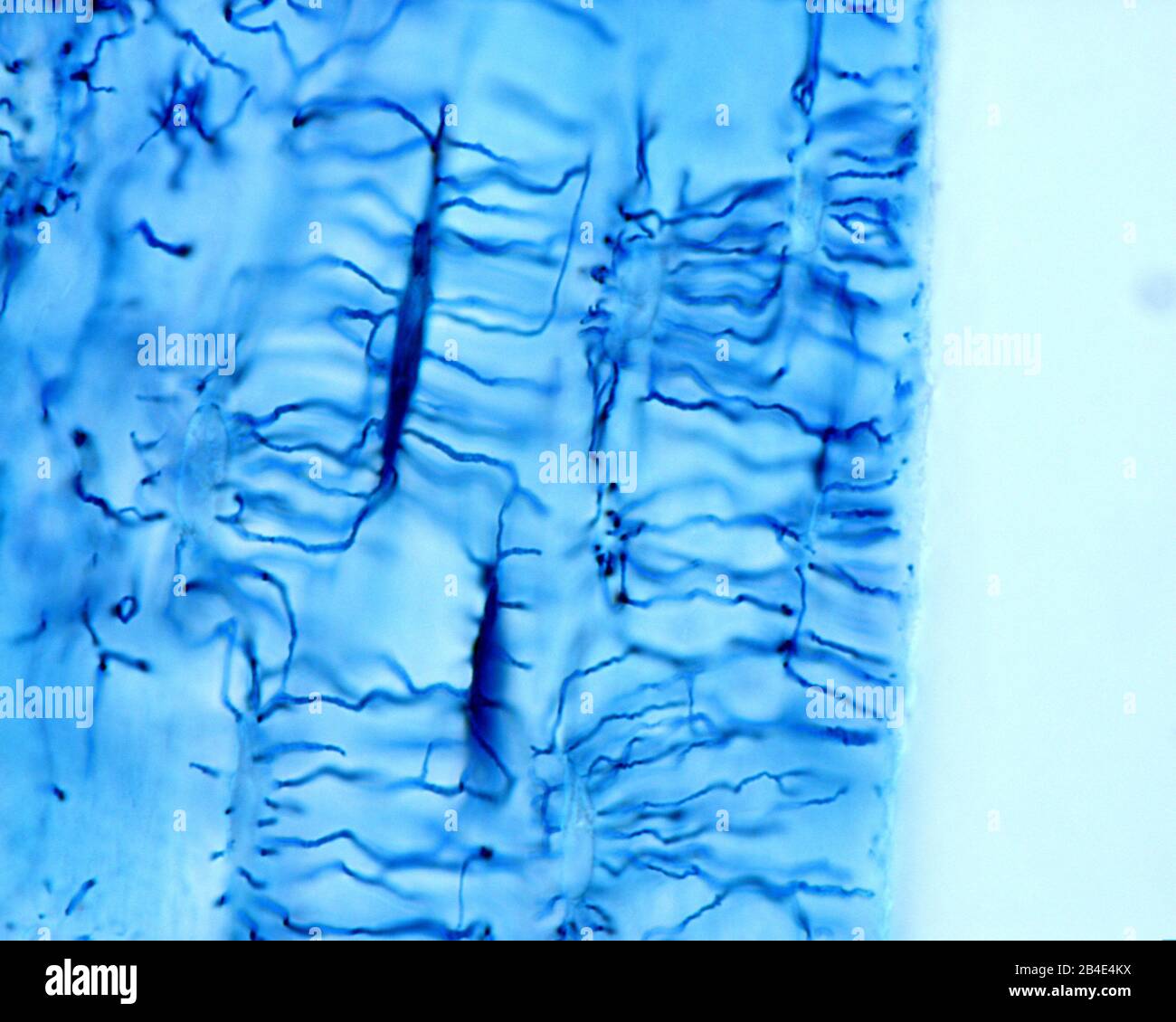 Schmorls technique hi-res stock photography and images - Alamy