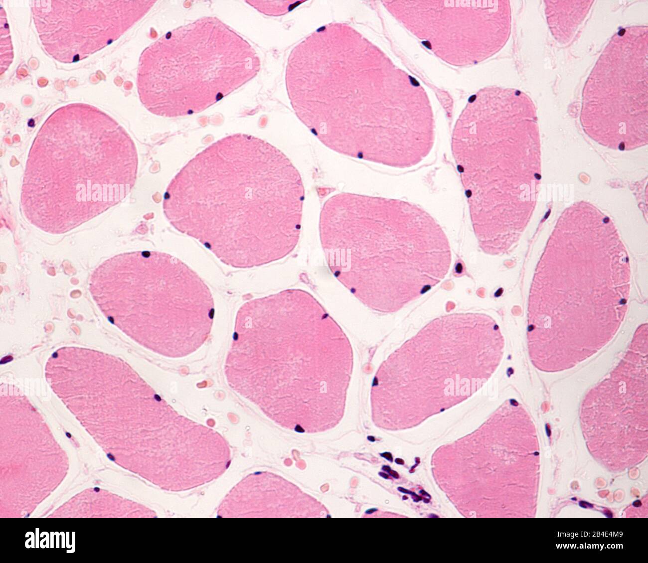 Skeletal Muscle Cross Section Slide Skeletal Muscle Cross Section Slide