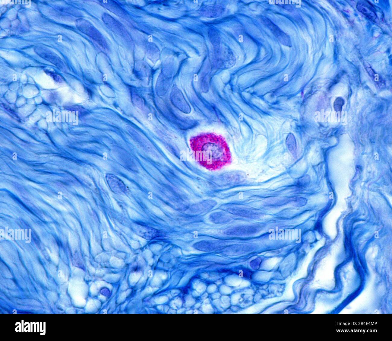 Mast cell or mastocyte with its cytoplasm filled with large granules ...