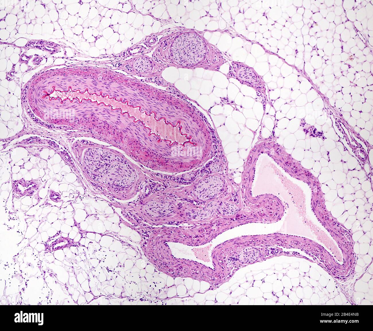 Muscular artery, vein and nerve bundles surrounded by adipose tissue ...