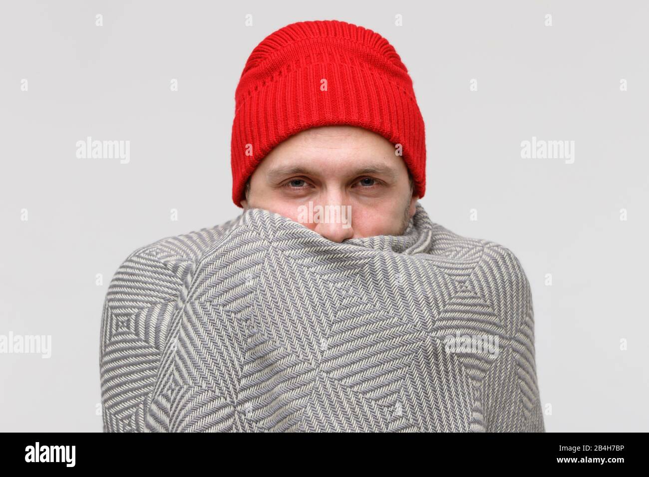 Red eyes sick hi-res stock photography and images - Alamy