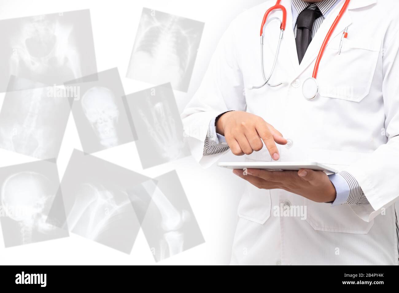 doctor holding tablet computer with x ray film background Stock Photo ...