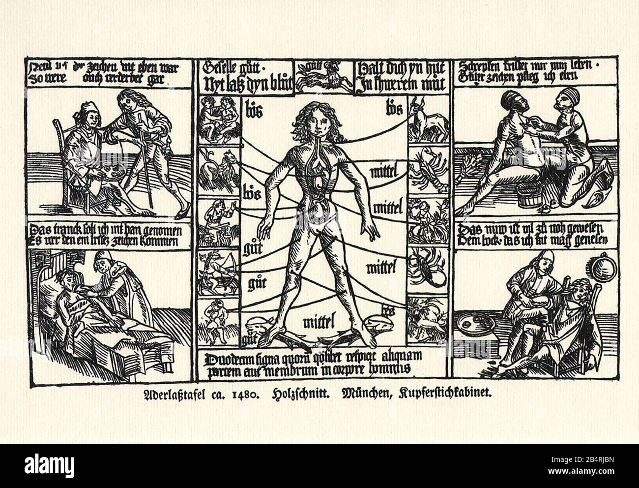 Bloodletting hi-res stock photography and images - Alamy