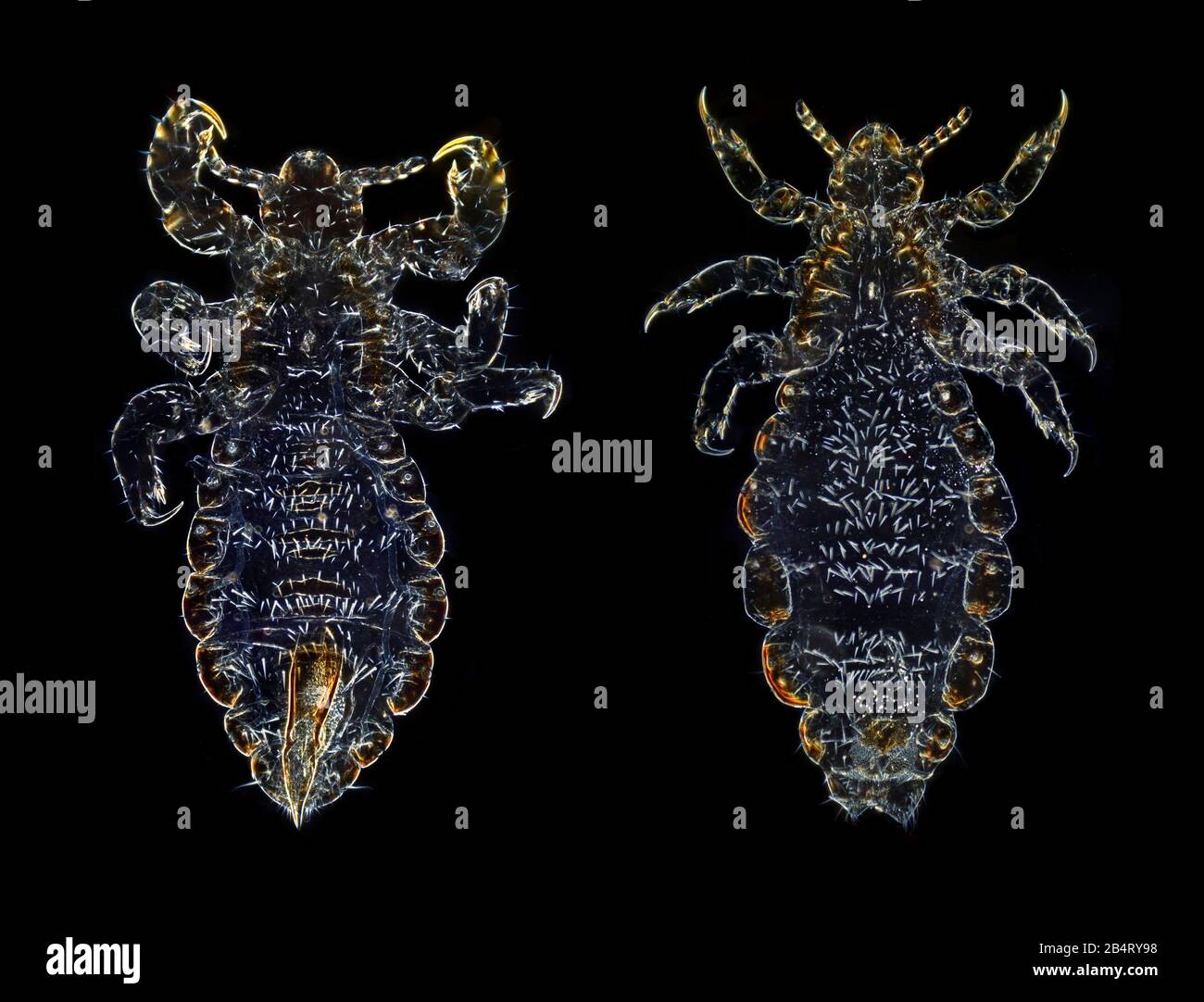 Pediculus capitis hi-res stock photography and images - Alamy