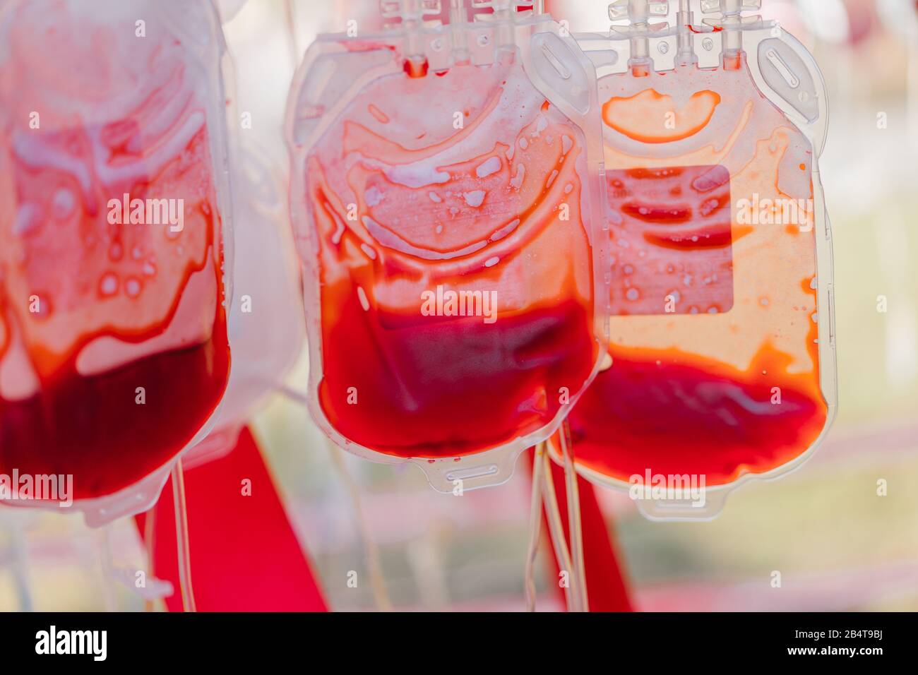 Surgery blood cell transfusion hi-res stock photography and images - Alamy