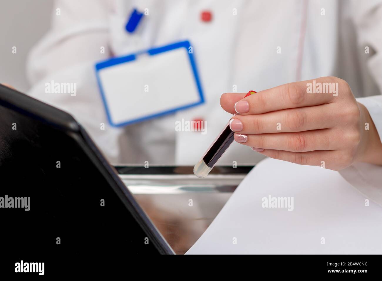 Nurse holds blood test tube during writing diagnosis blood sample in ...