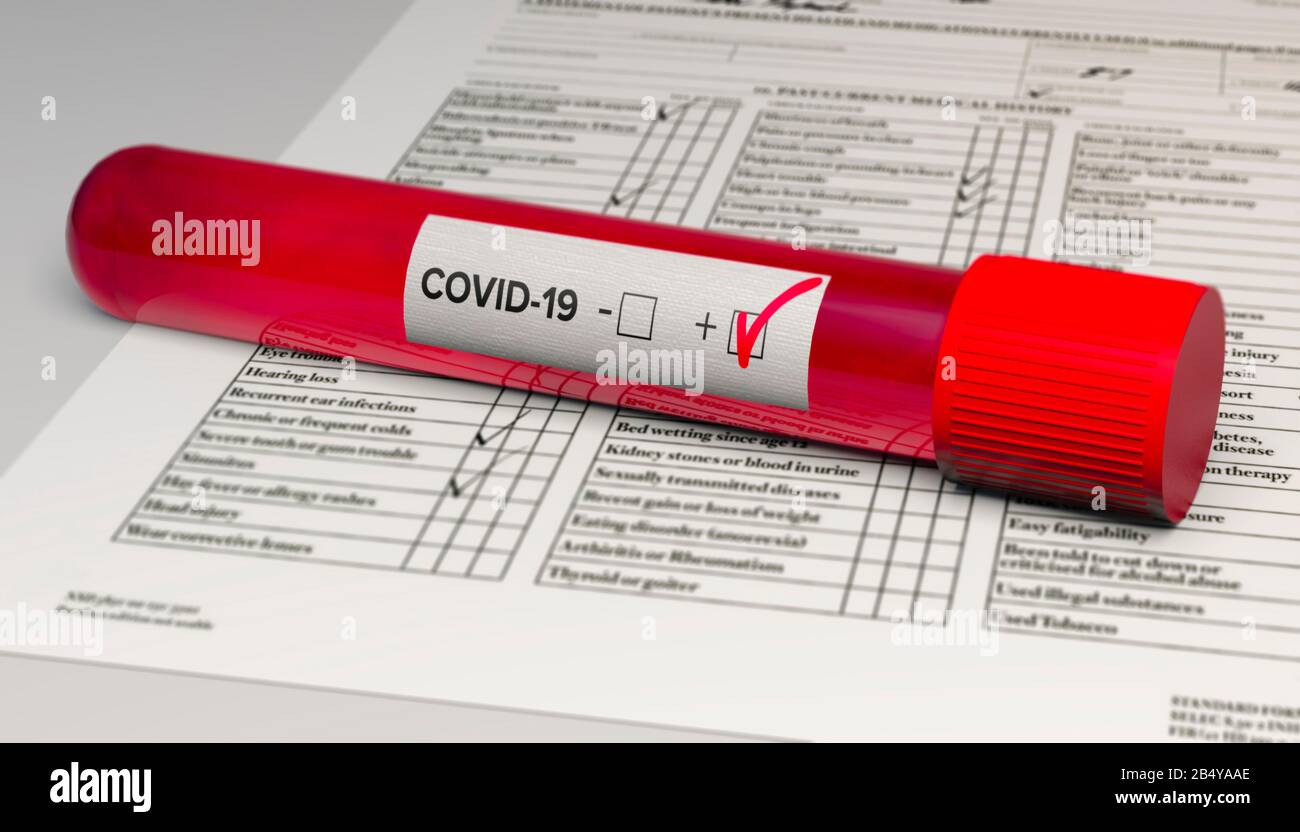 Covid-19 test tube, negative swab and positive swab. Swab sample ...