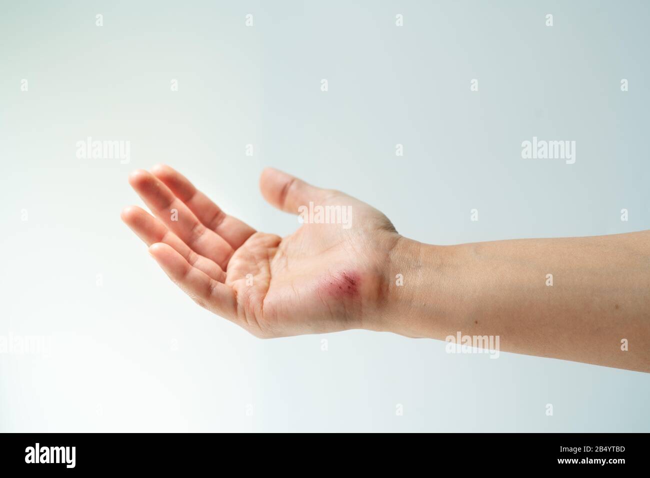 Blood Scratch Stock Photos & Blood Scratch Stock Images - Alamy