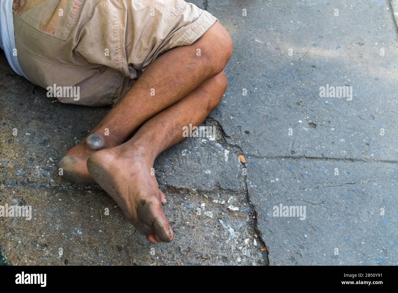 Barefoot homeless hi-res stock photography and images - Alamy
