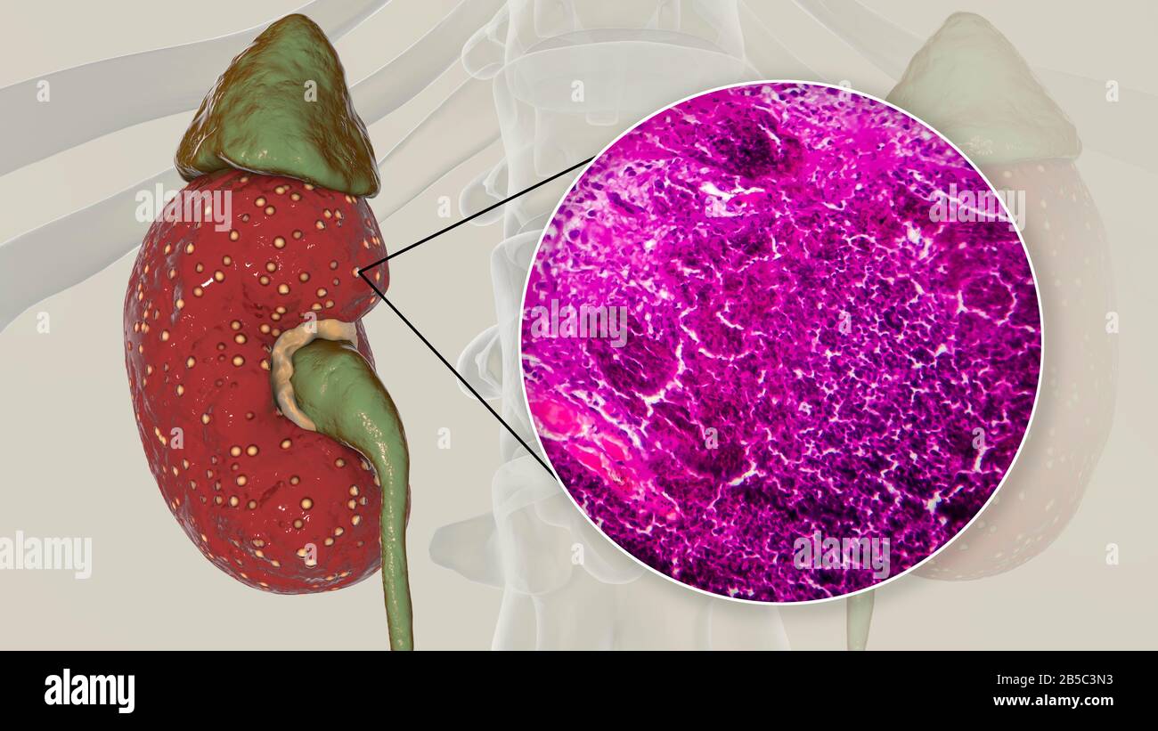 Urinary system light micrograph hi-res stock photography and images - Alamy
