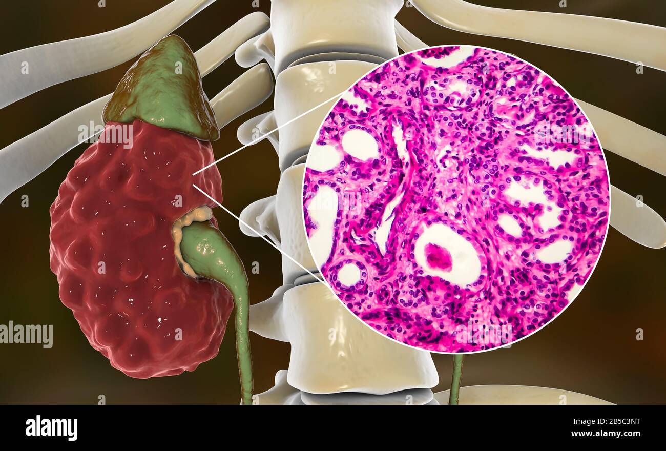 Urinary system histology hi-res stock photography and images - Alamy