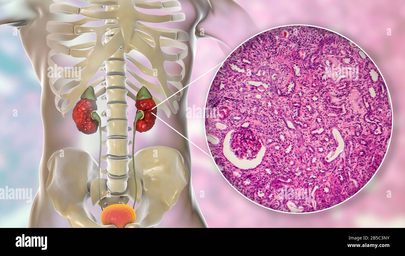 Urinary system histology hi-res stock photography and images - Alamy