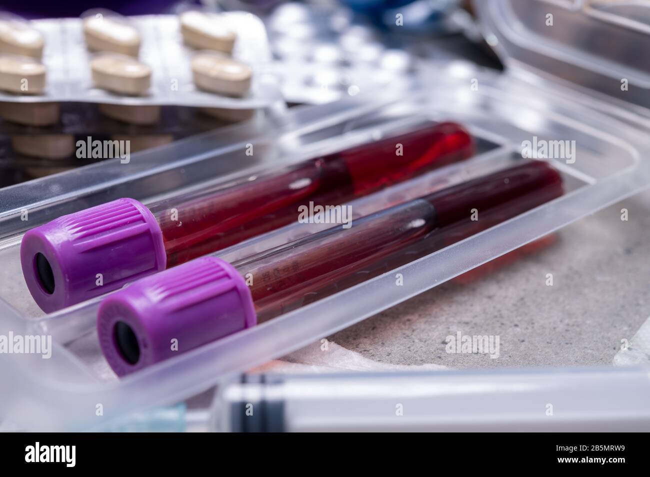 Medical test-tubes with blood samples for screening of virus, flu or ...