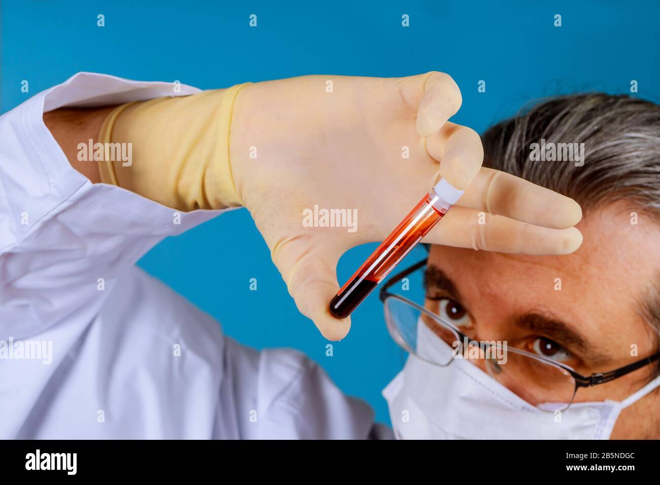Doctor holding test tube with blood plasma for testing in the clinical ...
