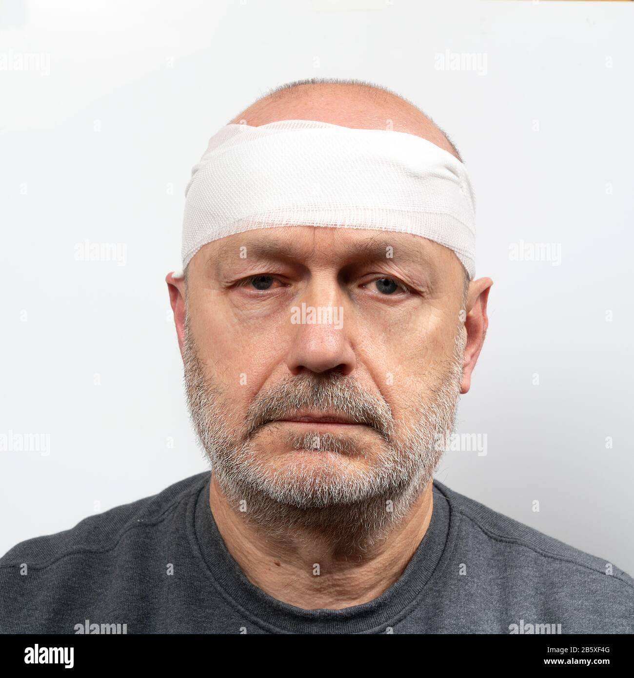Bandaged head hi-res stock photography and images - Alamy