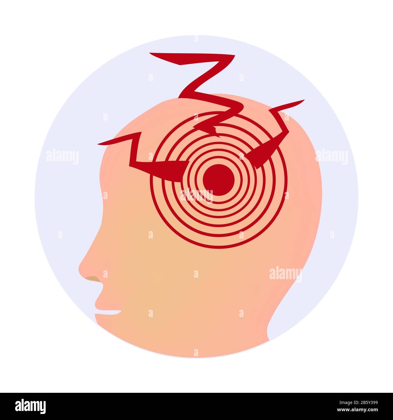 Headache. Symptom of influenza, allergies, bronchitis, pneumonia ...