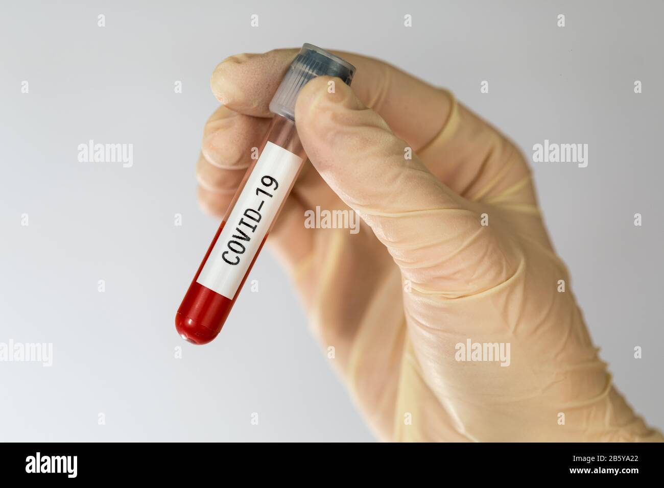 Laboratory sample of blood testing for diagnosis new Corona virus ...
