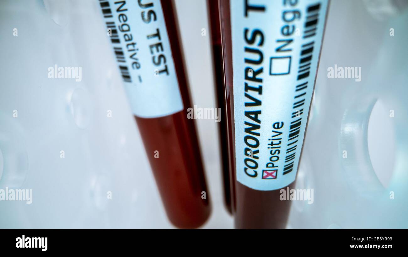 Blood sample tube for corona test, COVID-19. The virus has caused ...