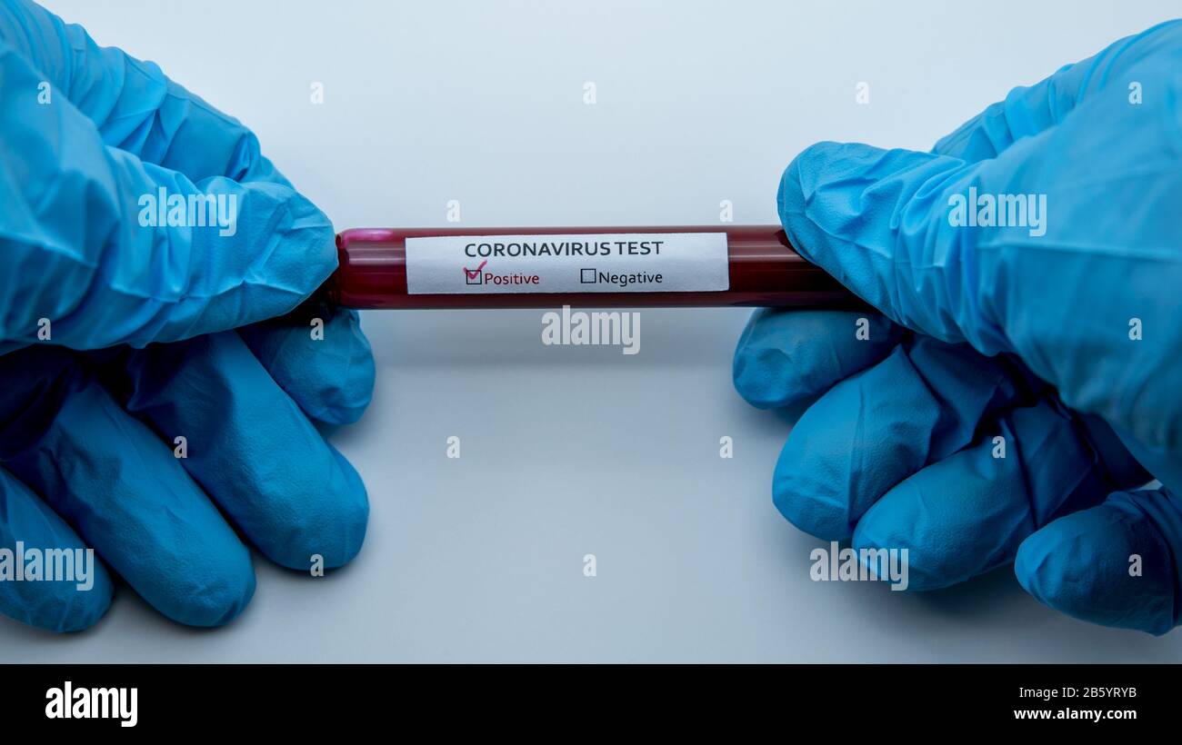 Virology Tube High Resolution Stock Photography and Images - Alamy