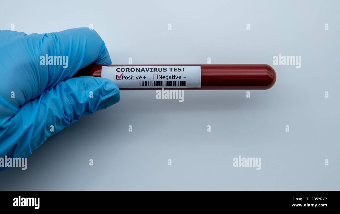 Test tube with infected blood sample for COVID-19, novel coronavirus ...