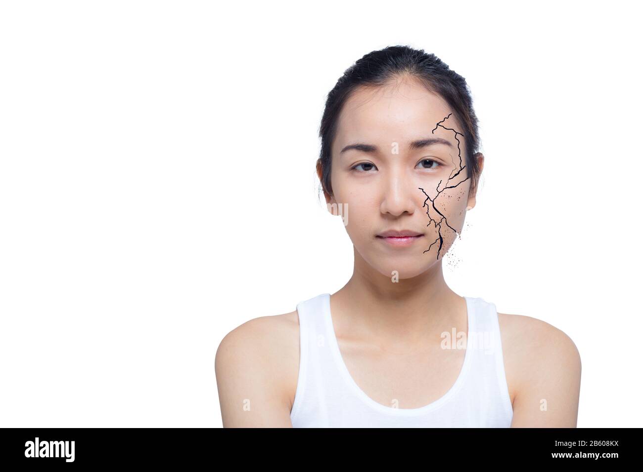 Closeup of woman cracked and damaged face as cosmetic and dehydration ...