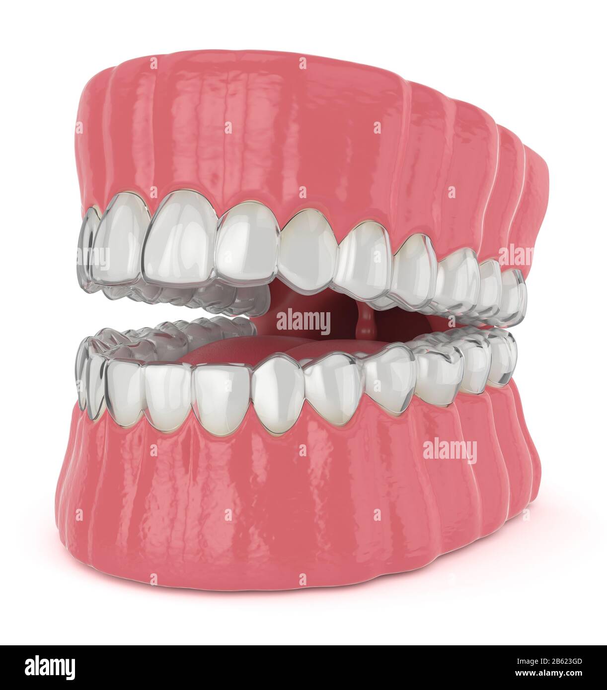 3d render of jaw with invisalign removable retainers over white ...