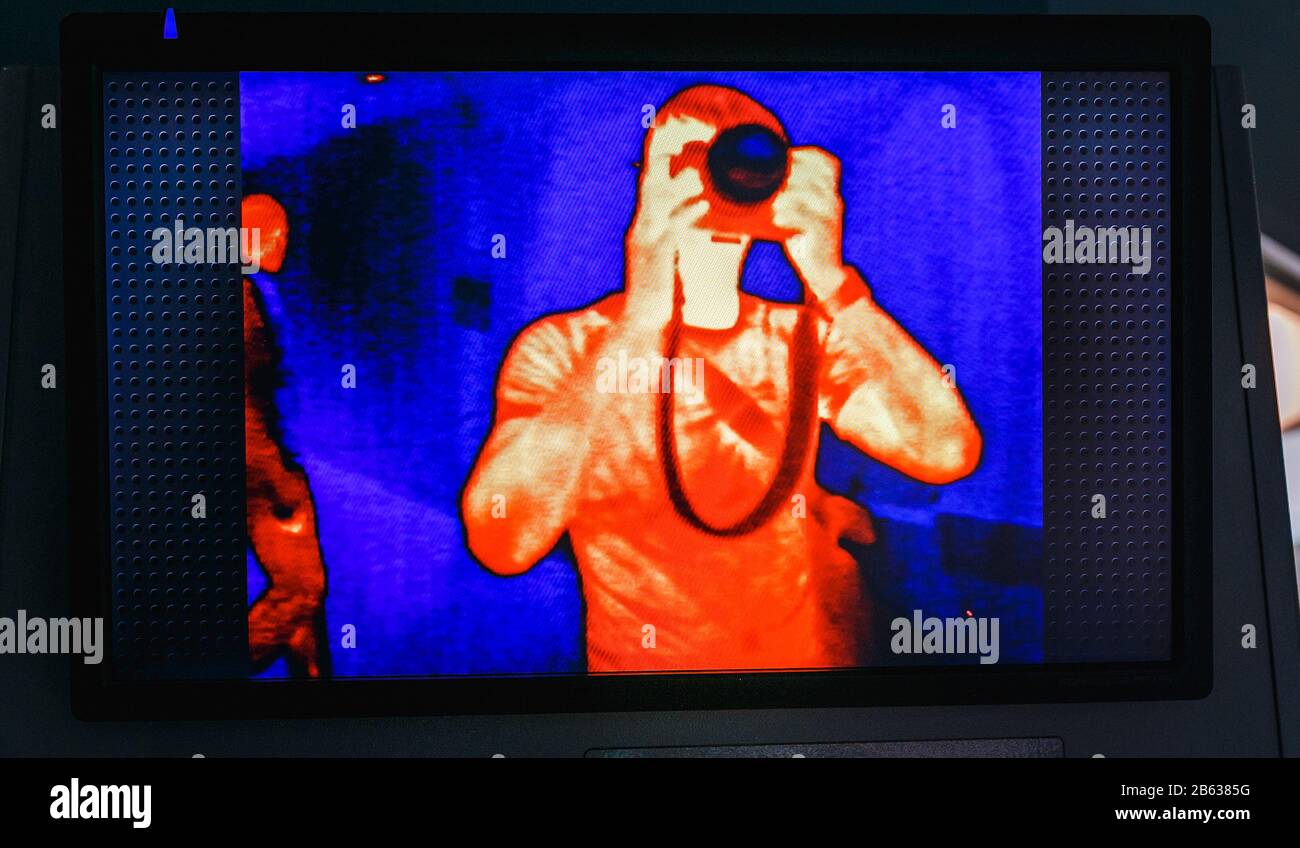 Thermography arm hi-res stock photography and images - Alamy