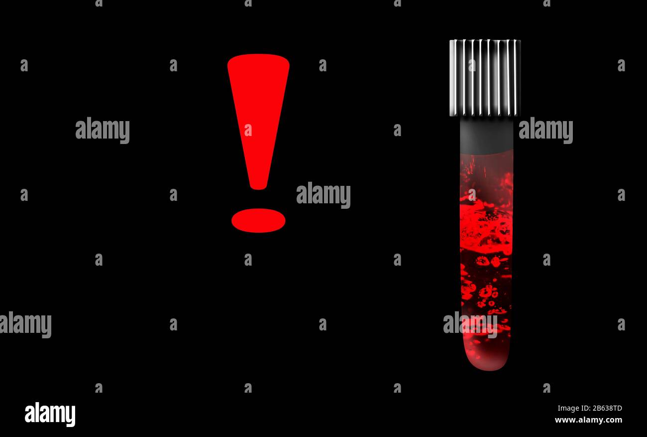 Test warning hi-res stock photography and images - Alamy