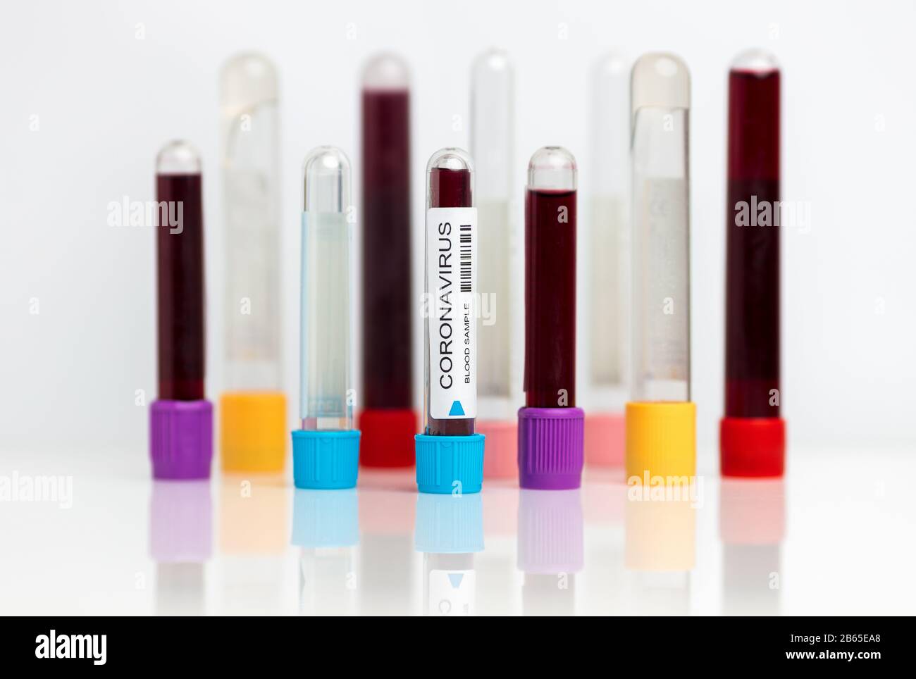Testing the laboratory sample of the novel Coronavirus Stock Photo - Alamy