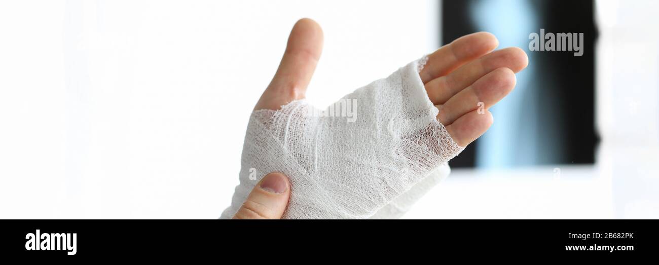 Elastic band finger hi-res stock photography and images - Alamy