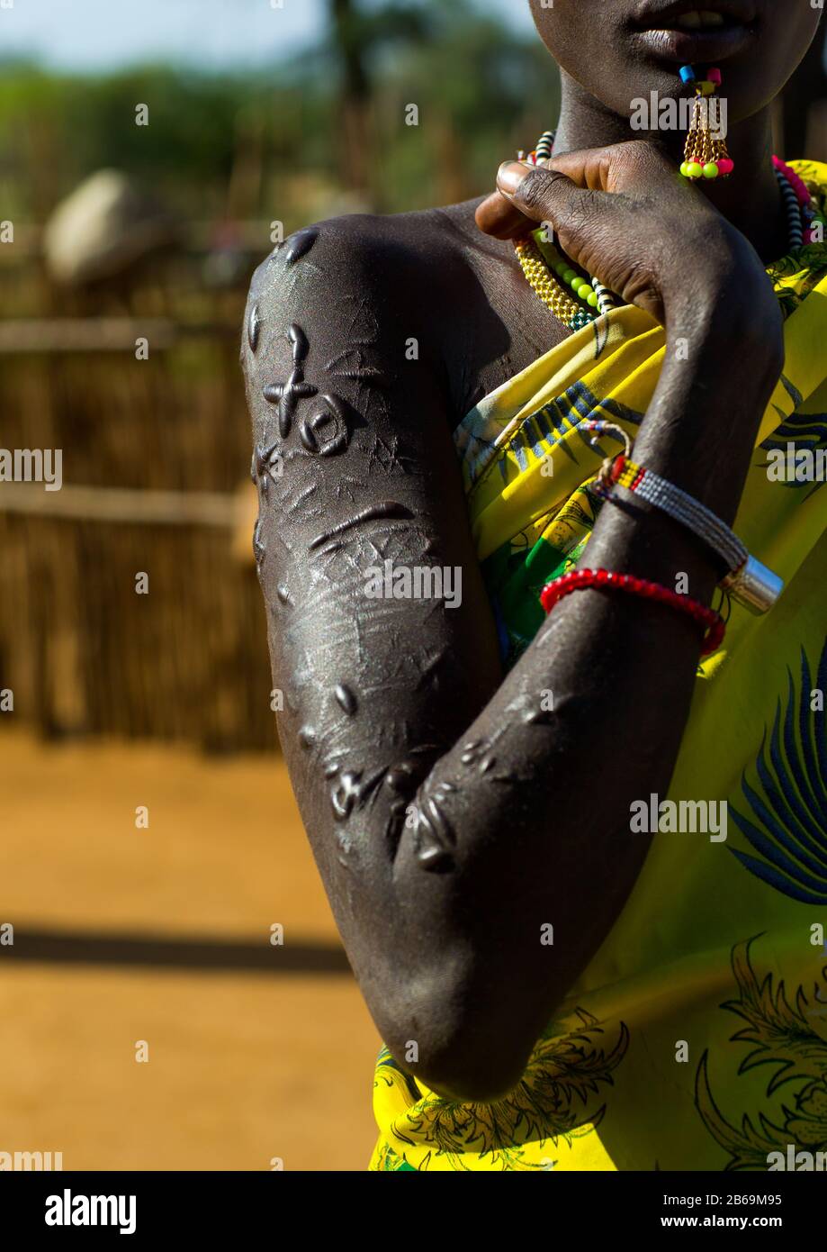 Scars arm hi-res stock photography and images - Alamy