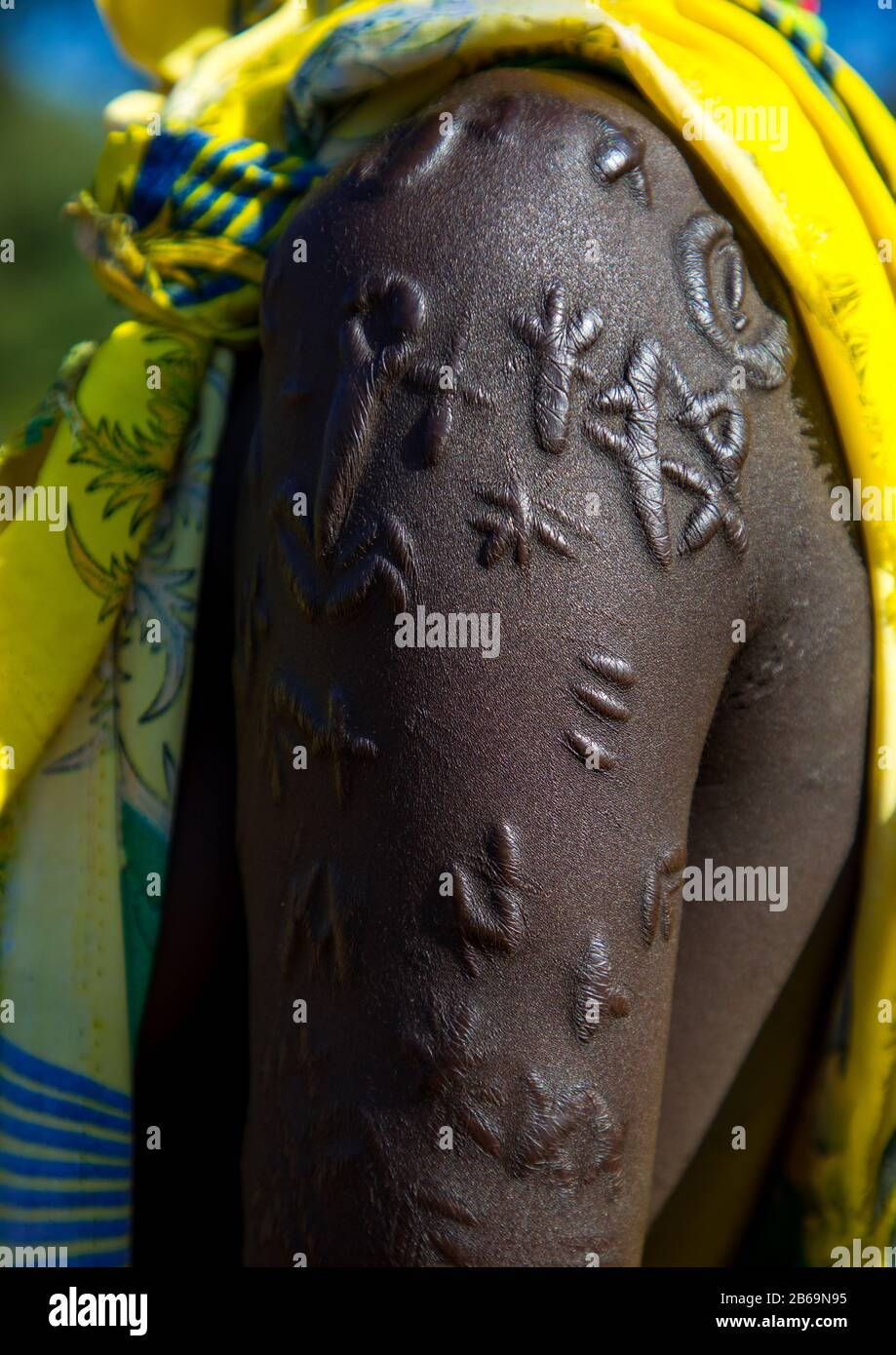 Scars arm hi-res stock photography and images - Alamy