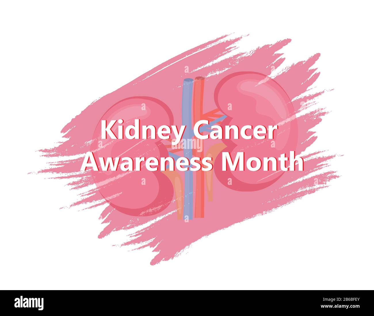 Kidney cancer awareness month in March. Pyelonephritis, diseases and ...