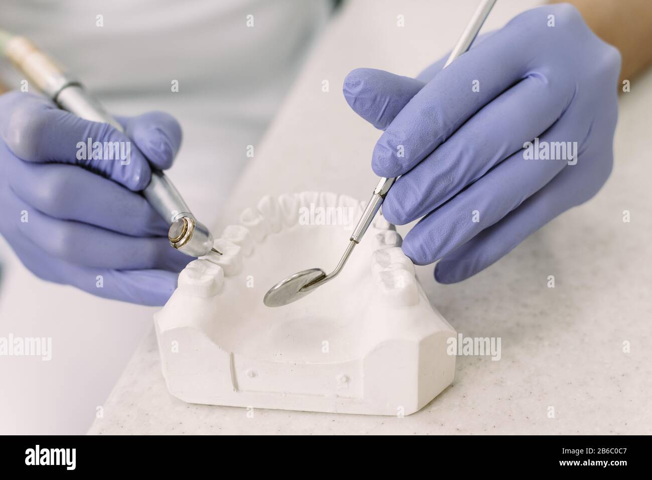 The dentist holds a drill with an implant. Close-up of dental drill use ...
