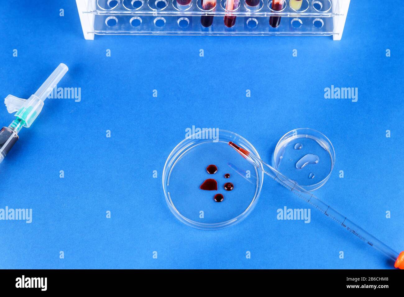 Test doctor COVID-19 blood sample vial in laboratory tube Stock Photo ...