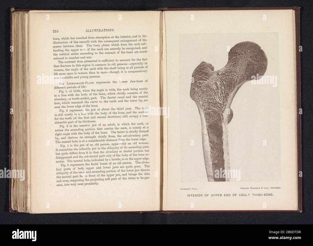 Femur end hi-res stock photography and images - Alamy