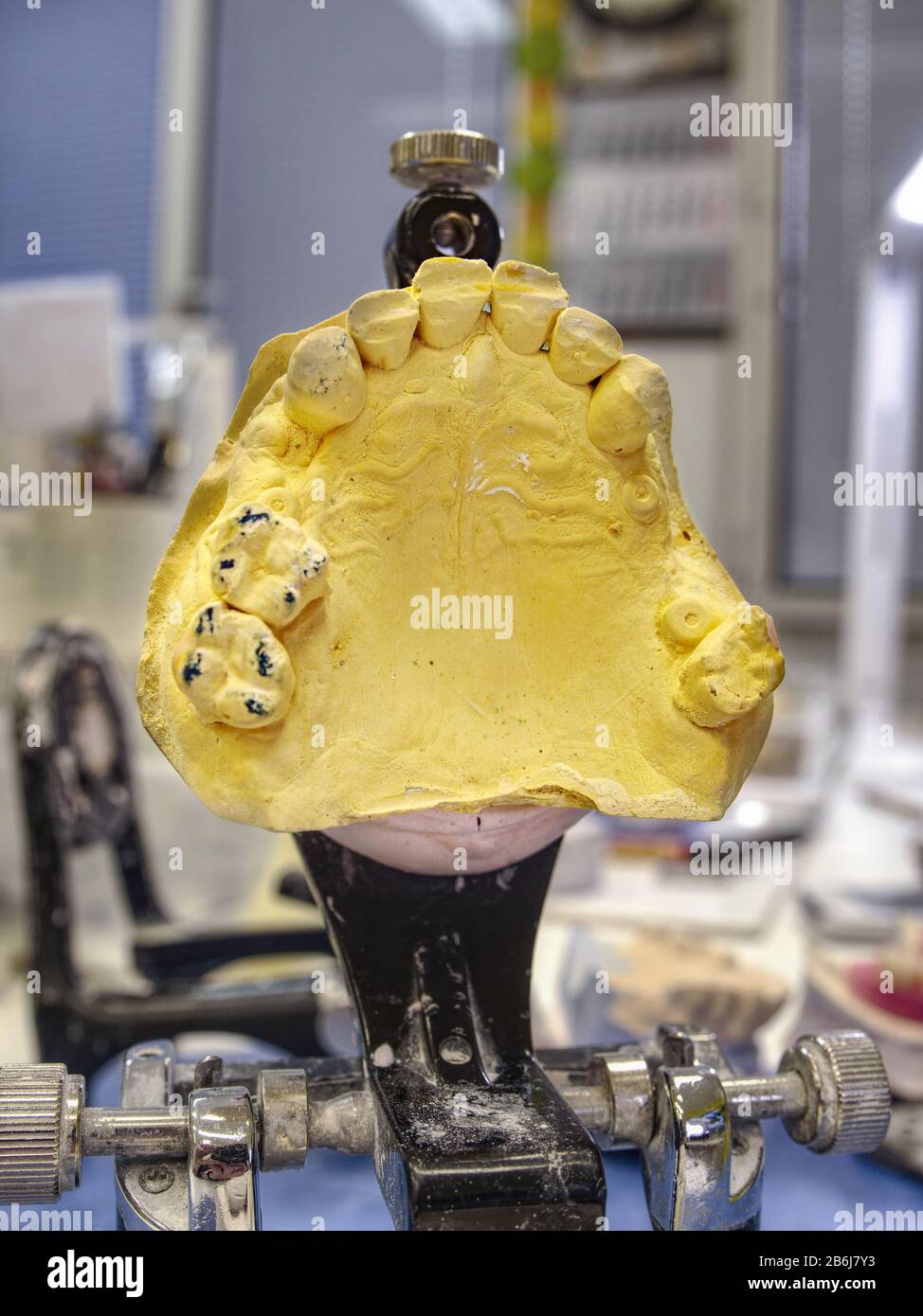 Test of bite. Plaster models with artificial tooth alignments on a ...