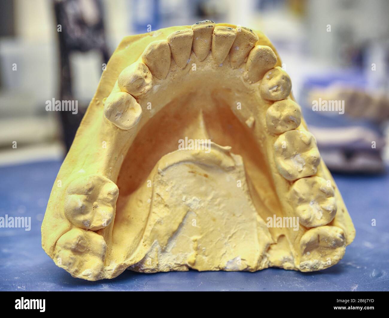 Tooth positioning hi-res stock photography and images - Alamy