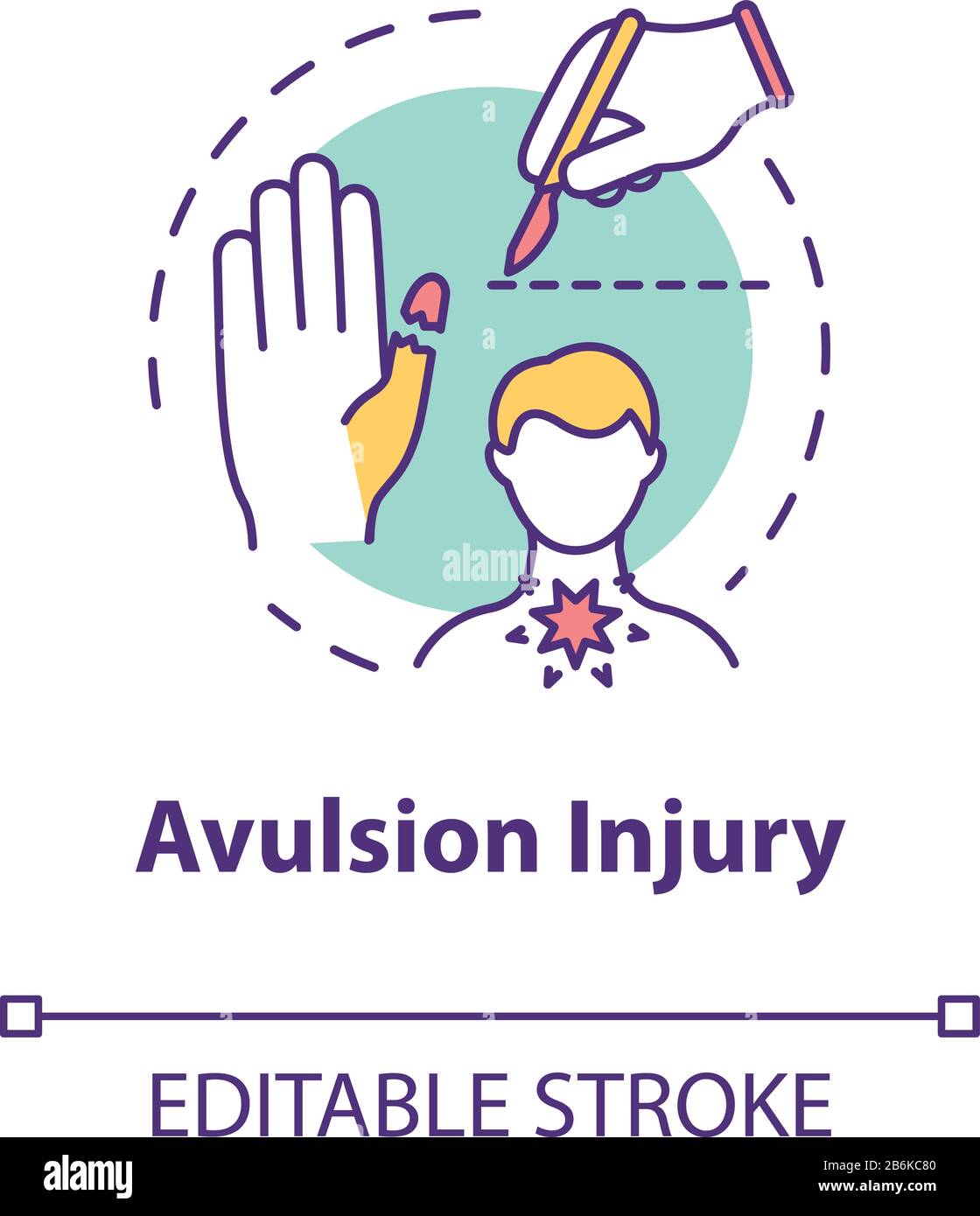 Avulsion wound hi-res stock photography and images - Alamy