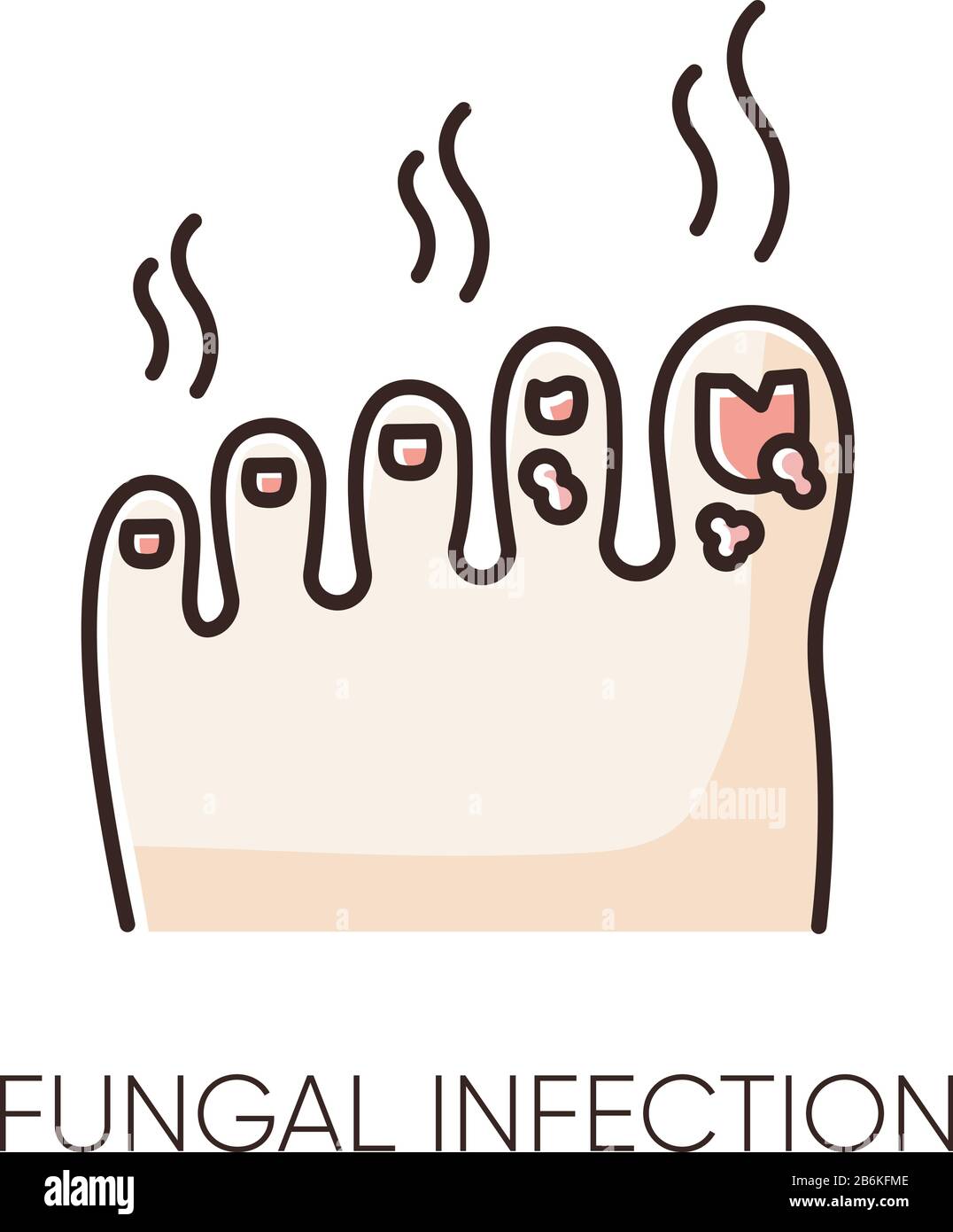 Fungal infection RGB color icon. Dermatological infectious disease ...