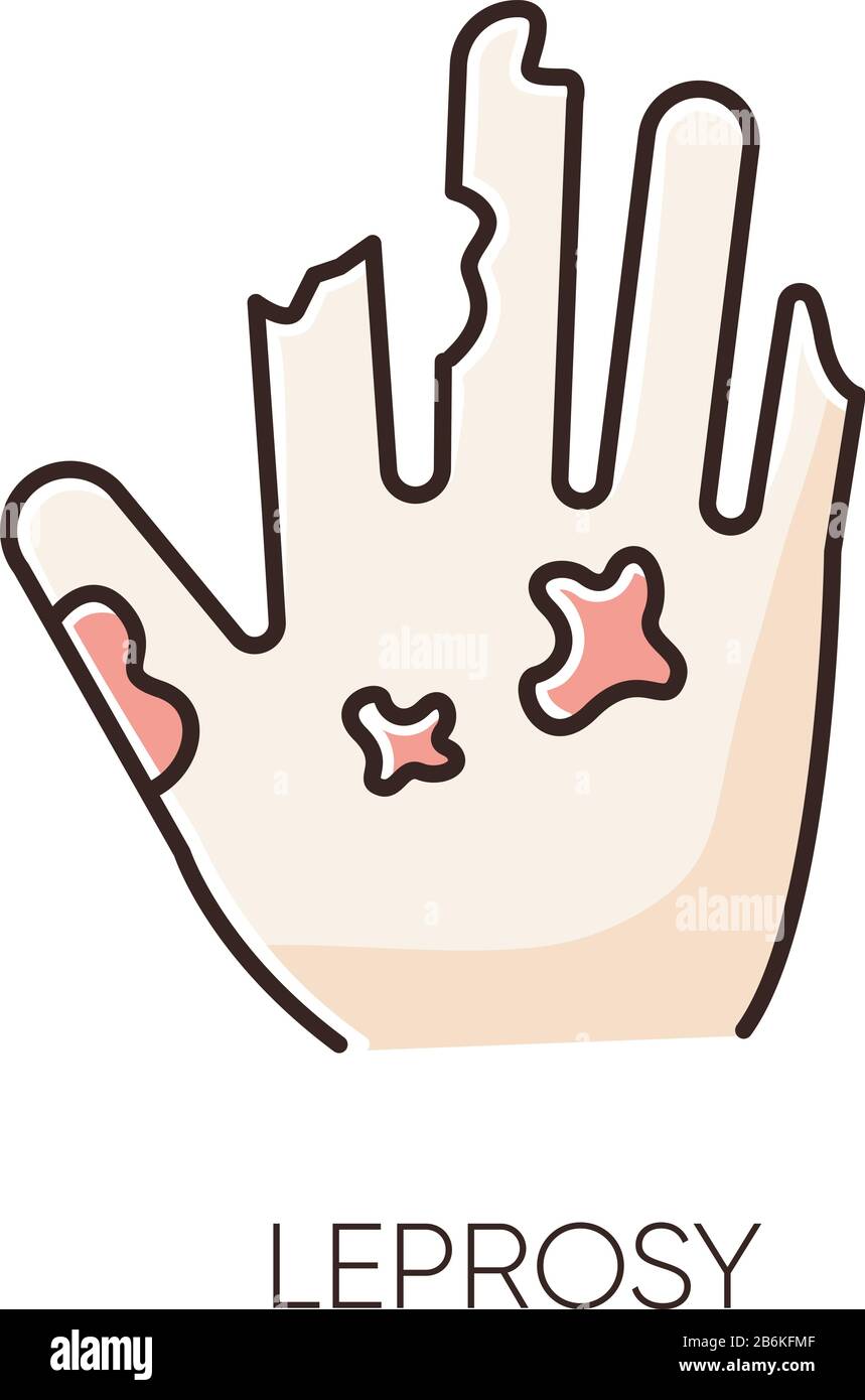 Leprosy RGB color icon. Dangerous bacterial disease, contagious illness ...