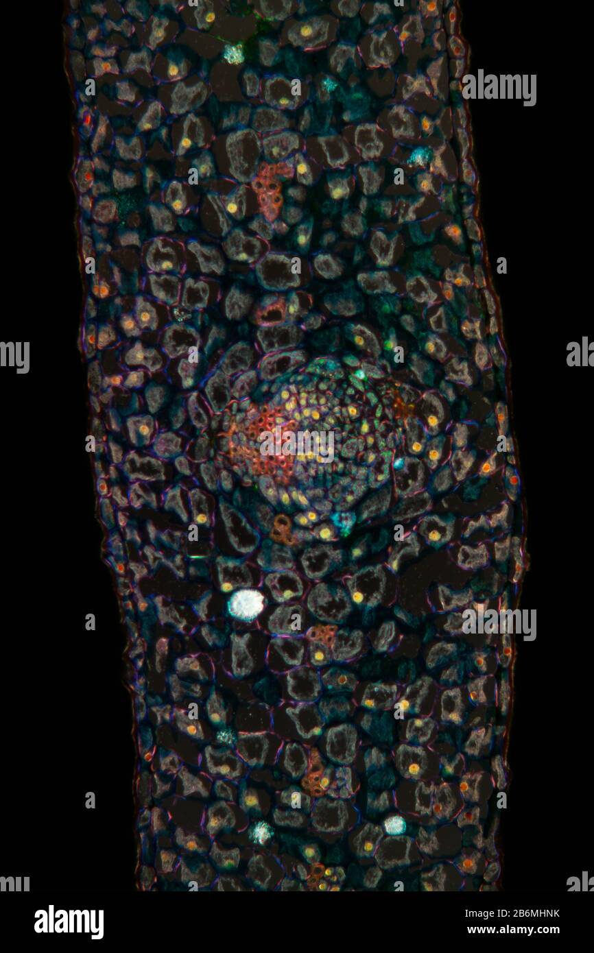 Mistletoe cross-section in the dark field 100x Stock Photo - Alamy