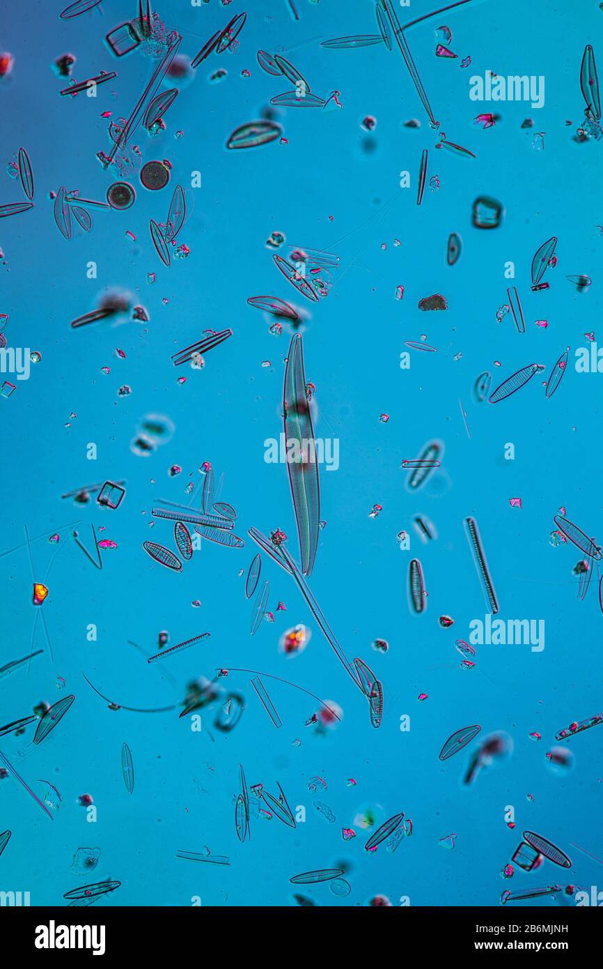 tiny microscopic diatoms in drops of water Stock Photo - Alamy