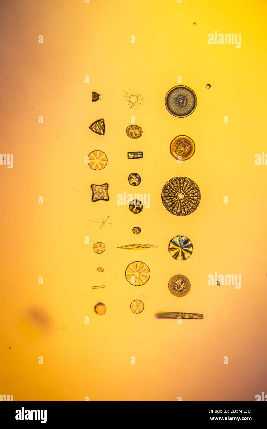 tiny microscopic diatoms in drops of water Stock Photo - Alamy