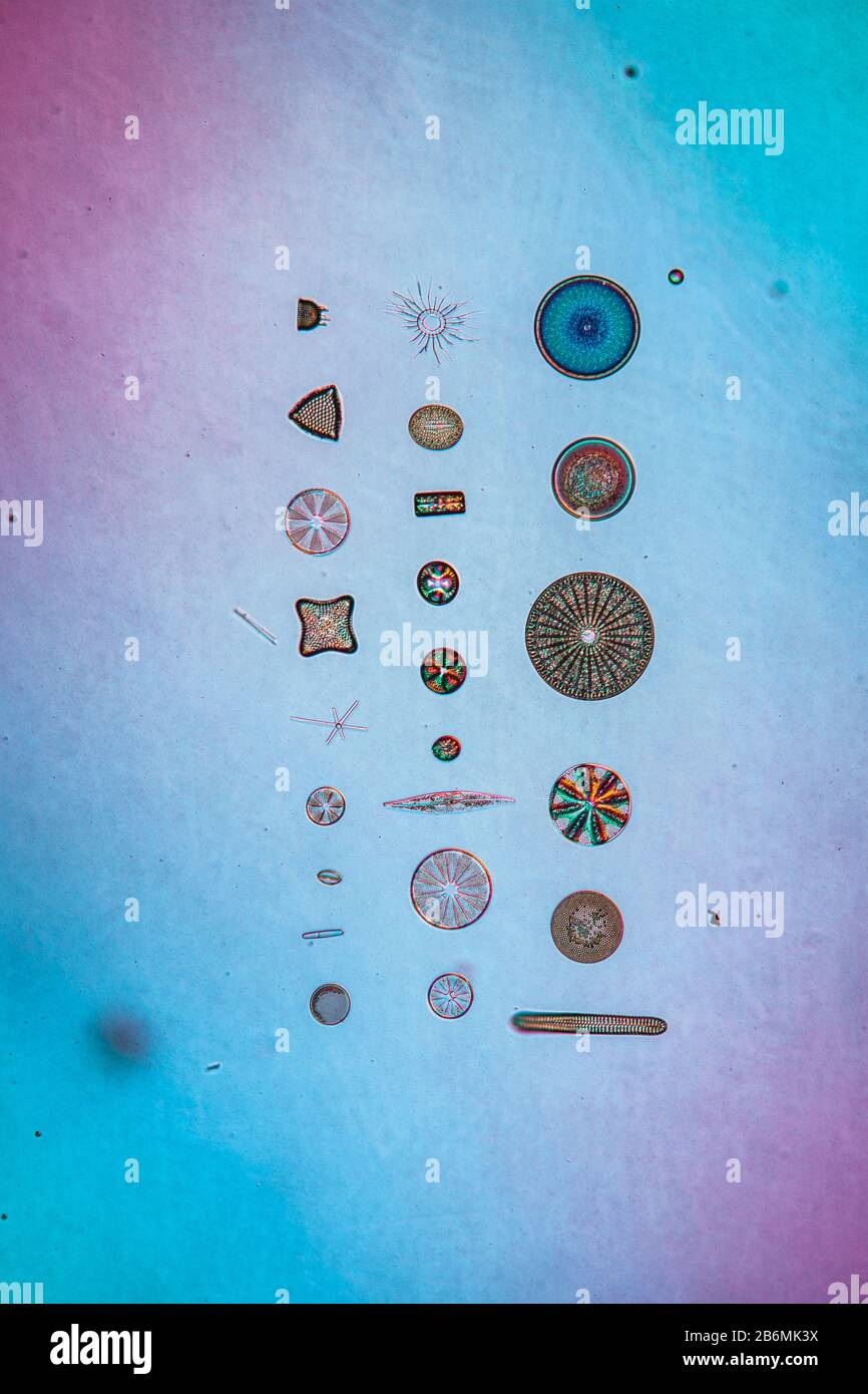 tiny microscopic diatoms in drops of water Stock Photo - Alamy