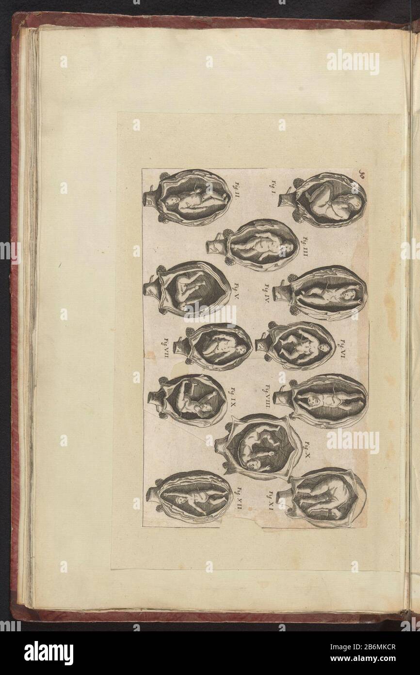 Foetus in womb hi-res stock photography and images - Alamy