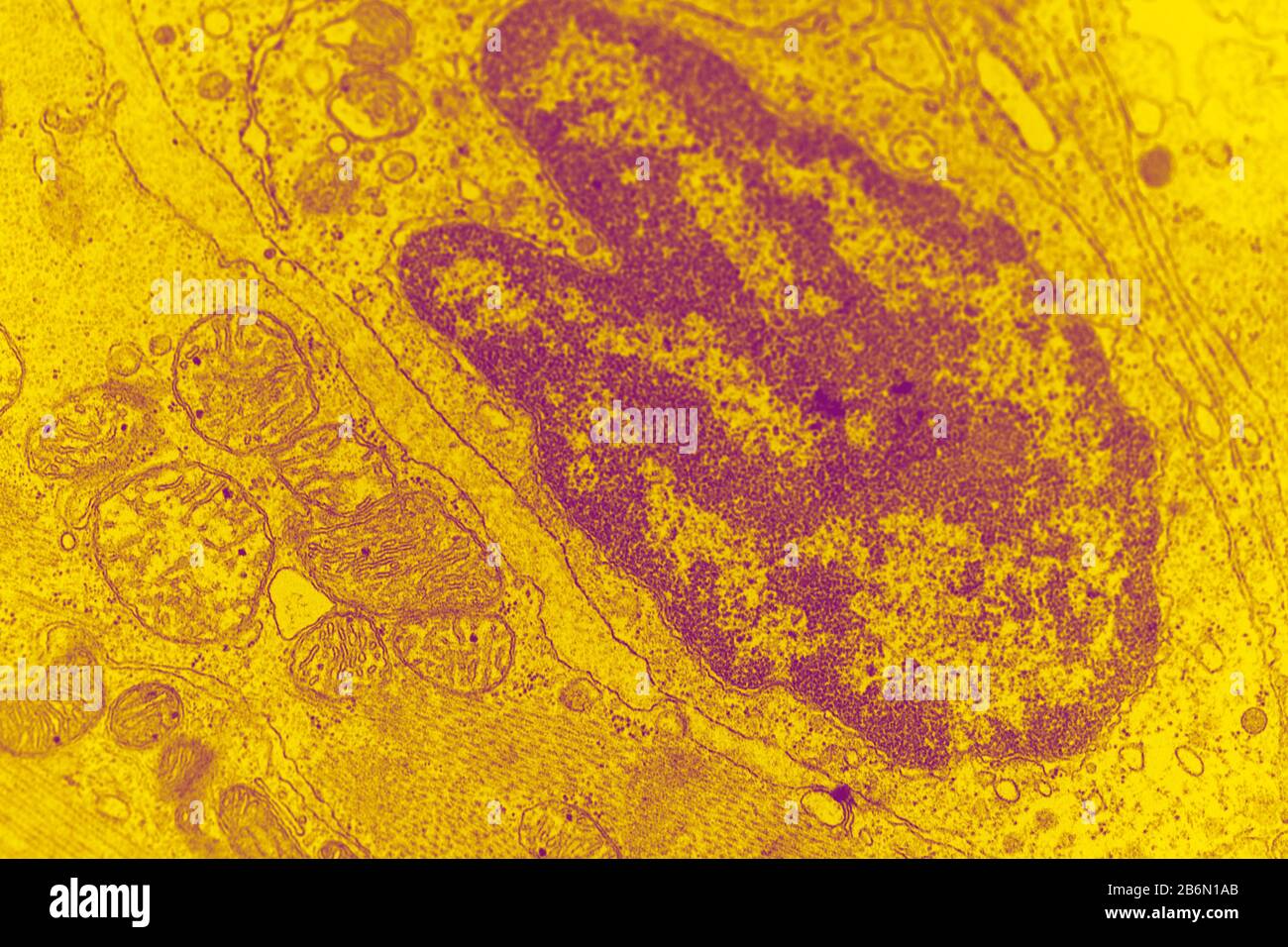 Electron micrograph of a cell nucleus at high magnification Stock Photo ...