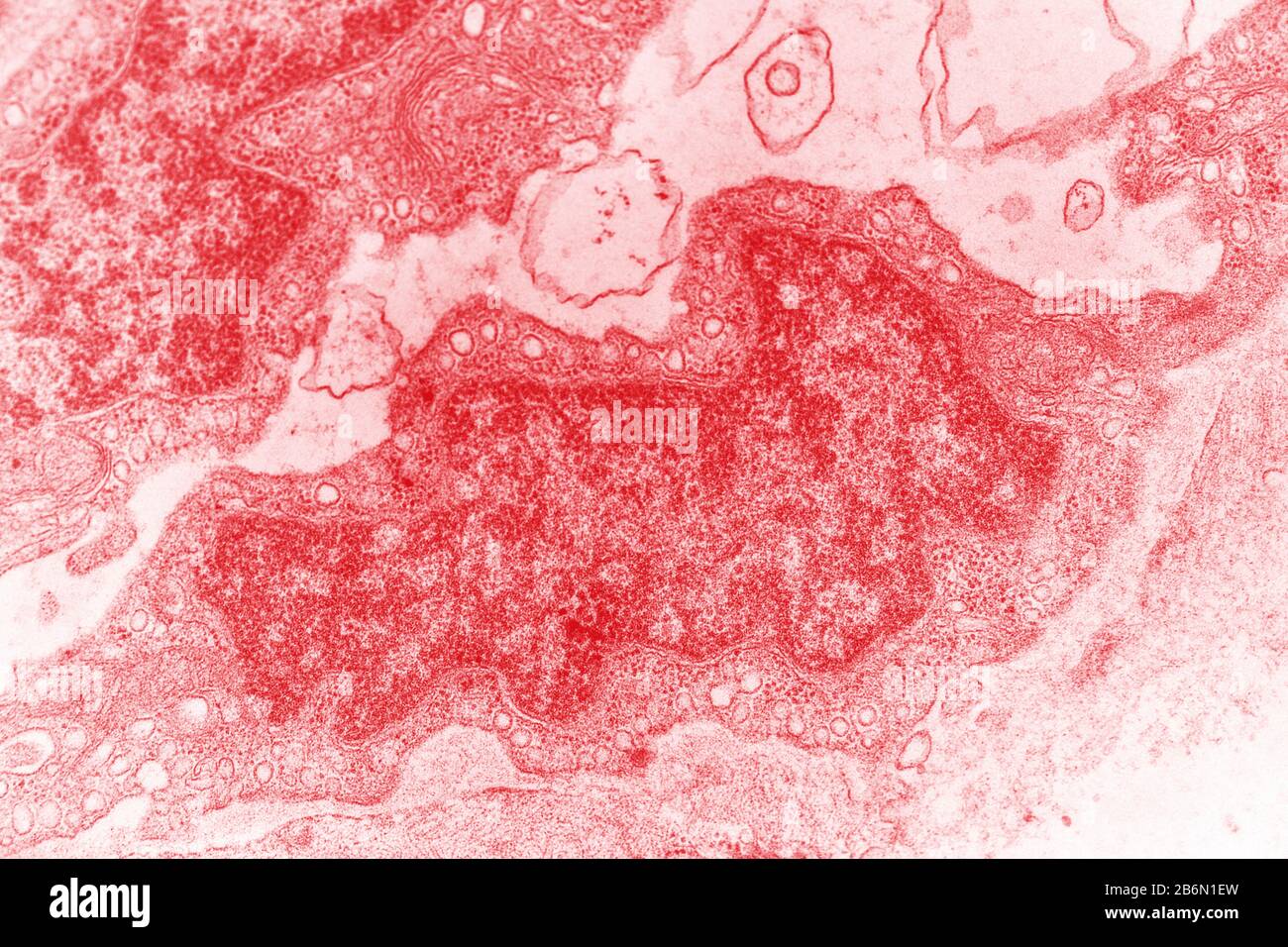 Cell nucleus electron microscopy hi-res stock photography and images ...