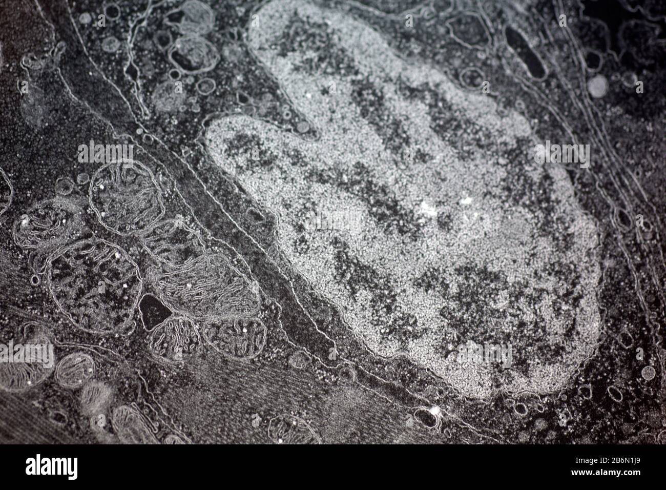 Electron micrograph of a cell nucleus at high magnification Stock Photo ...